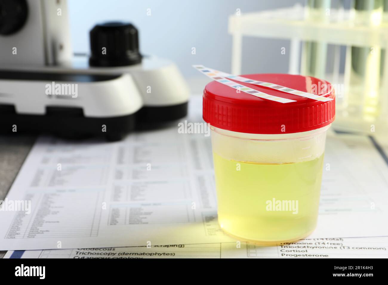 Container with urine sample for analysis on test forms in laboratory ...