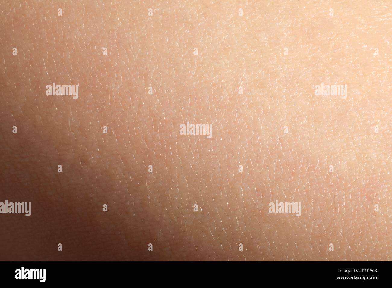 Closeup view of dry human skin as background Stock Photo - Alamy