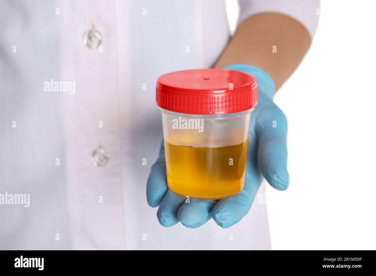 Nurse holding container with urine sample for analysis on white ...