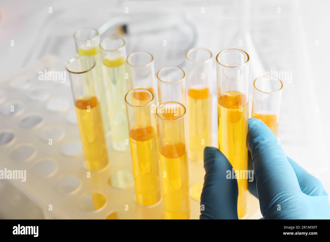 Nurse holding tube with urine sample, closeup. Specimen collection ...
