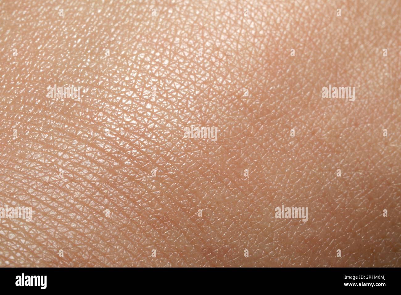 Closeup view of dry human skin as background Stock Photo - Alamy