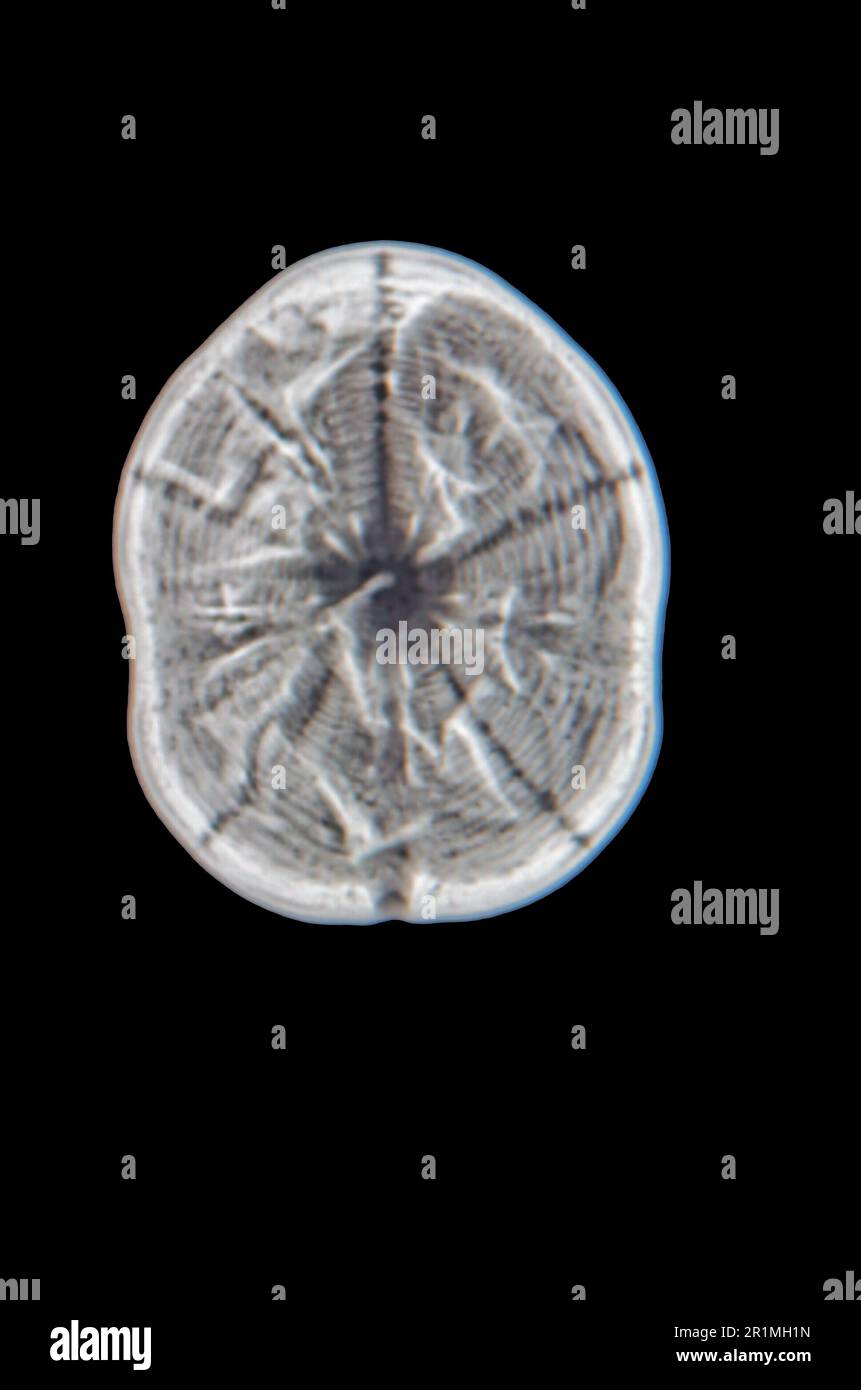 Sand Dollar x-ray Stock Photo - Alamy