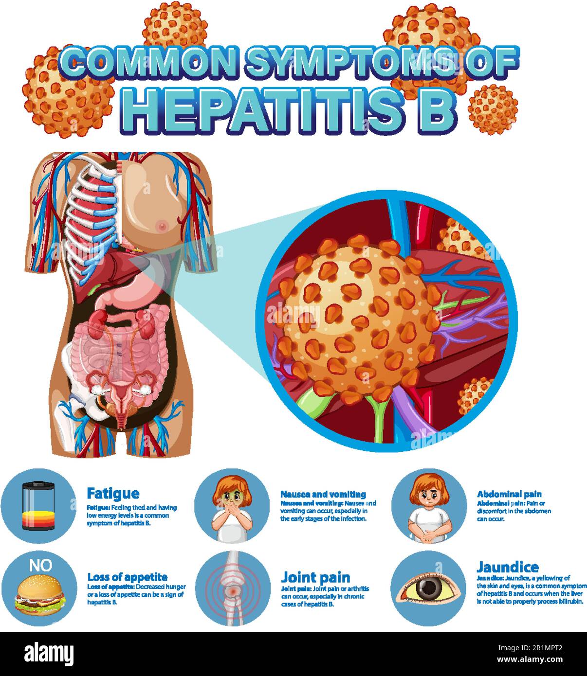 Informative poster of common symptoms Hepatitis B illustration Stock ...