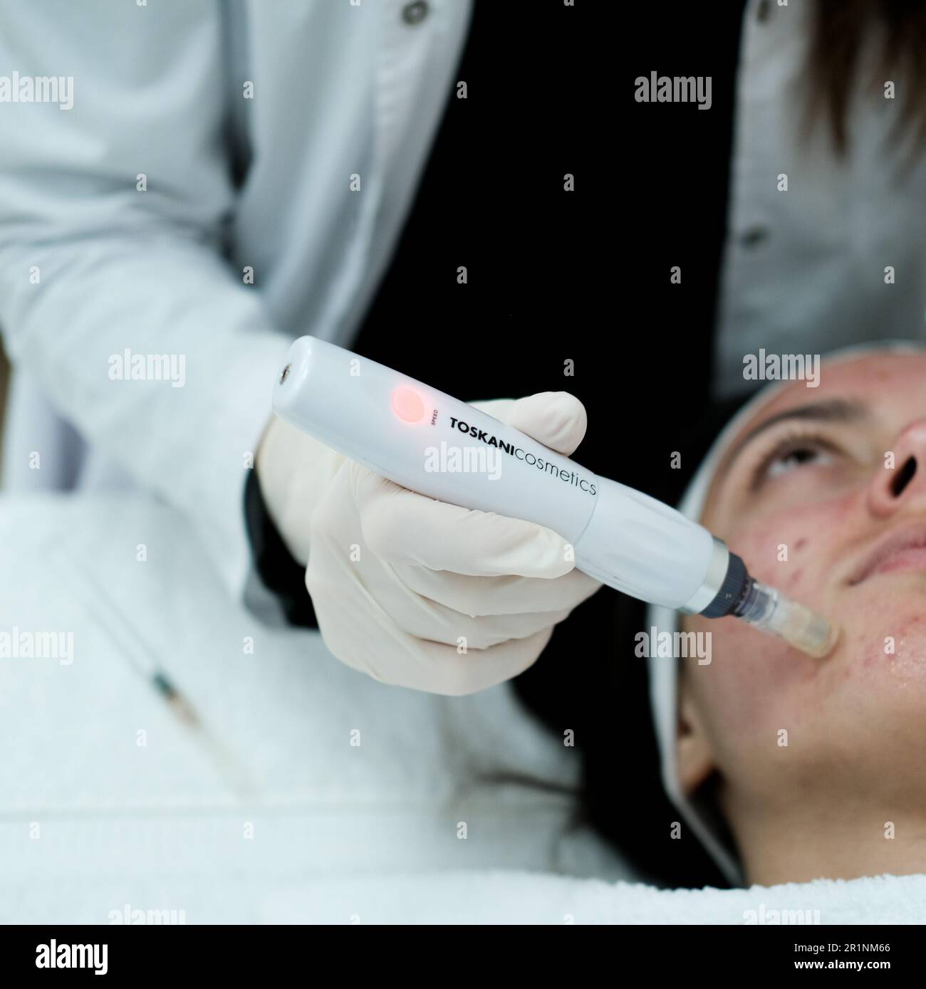 Closeup view of cosmetologist doing microneedling procedure on female ...