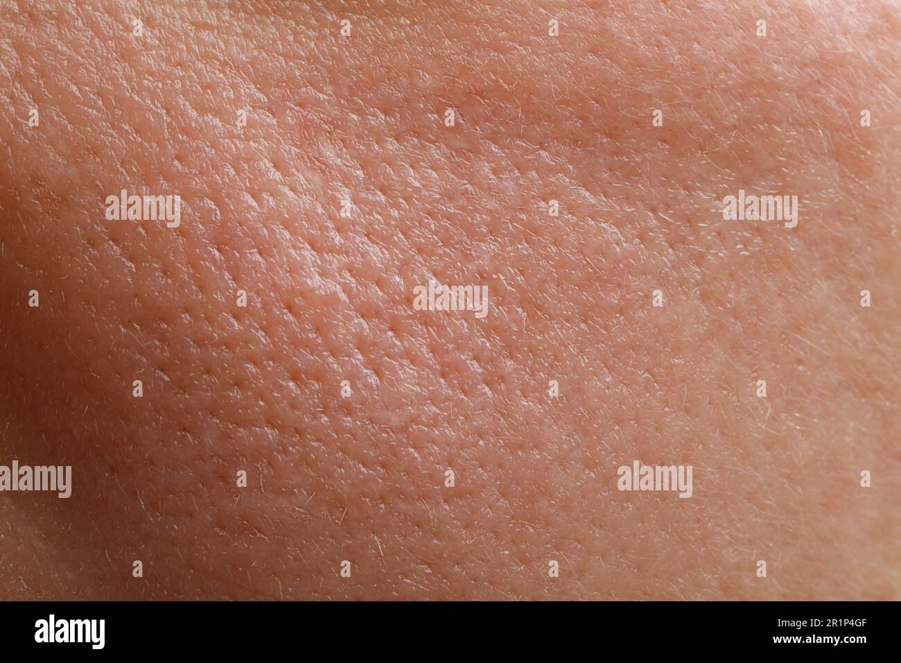 Closeup view of human oily skin as background Stock Photo - Alamy