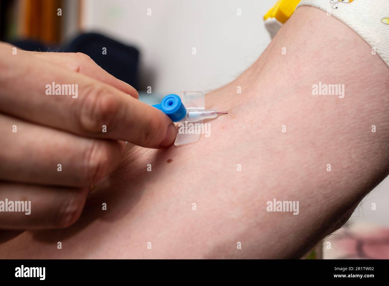 Doctor inserting intravenous catheter hi-res stock photography and ...