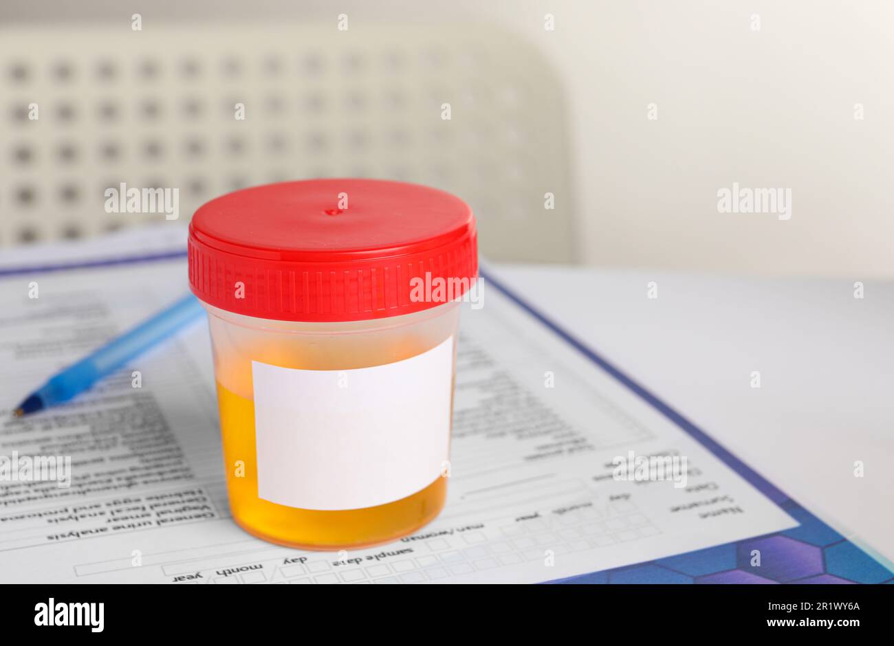 Container with urine sample on table in laboratory, space for text ...