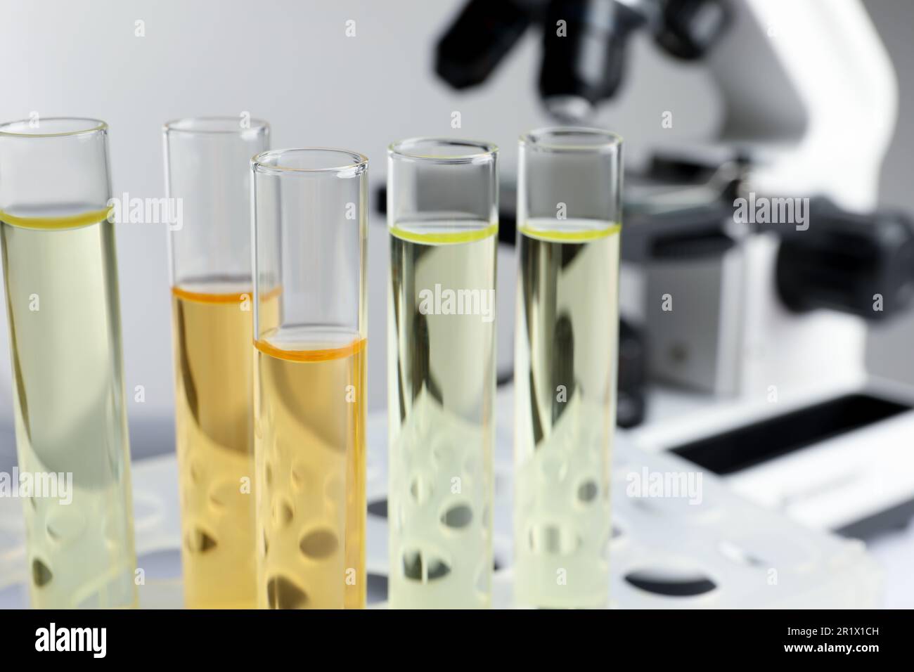 Tubes with urine samples for analysis in laboratory, closeup Stock ...