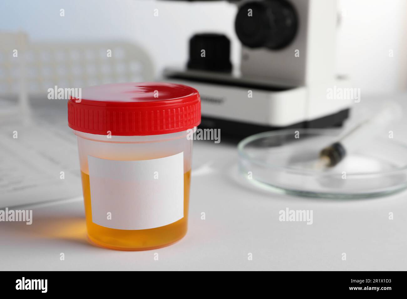 Container with urine sample on white table in laboratory, space for ...