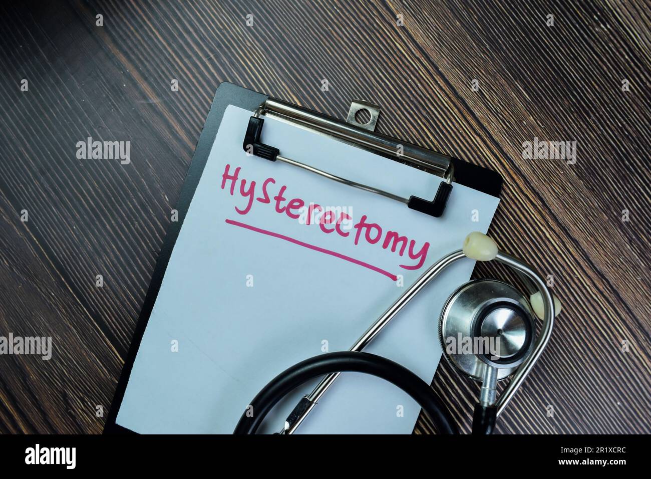 Concept of Hysterectomy write on sticky notes with stethoscope isolated ...