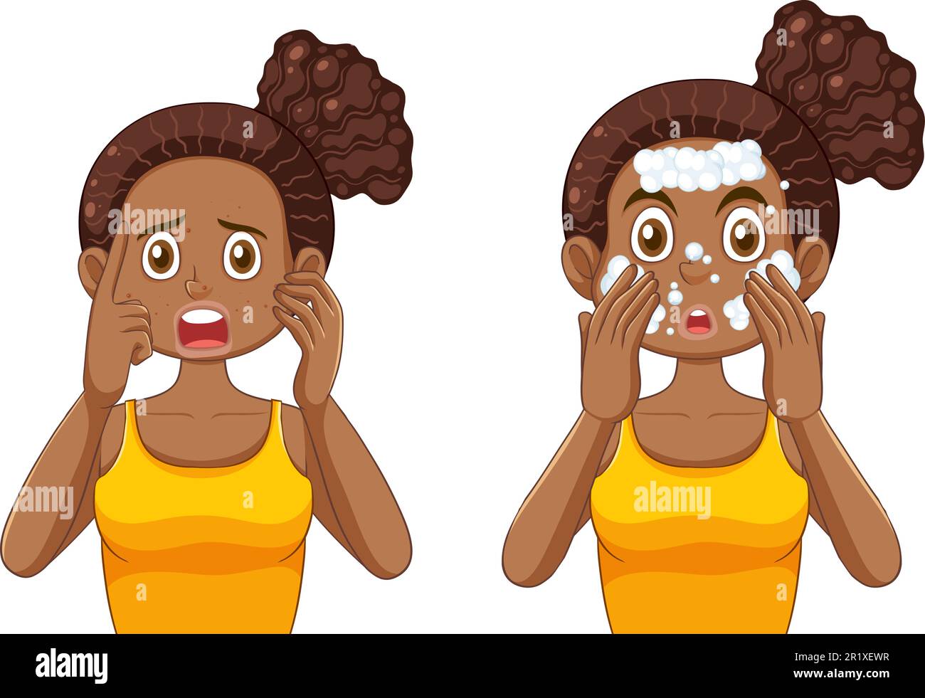 Young African American girl with skin problem illustration Stock Vector ...