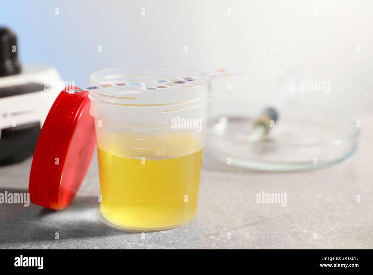 Container with urine sample for analysis and test strips on grey table ...