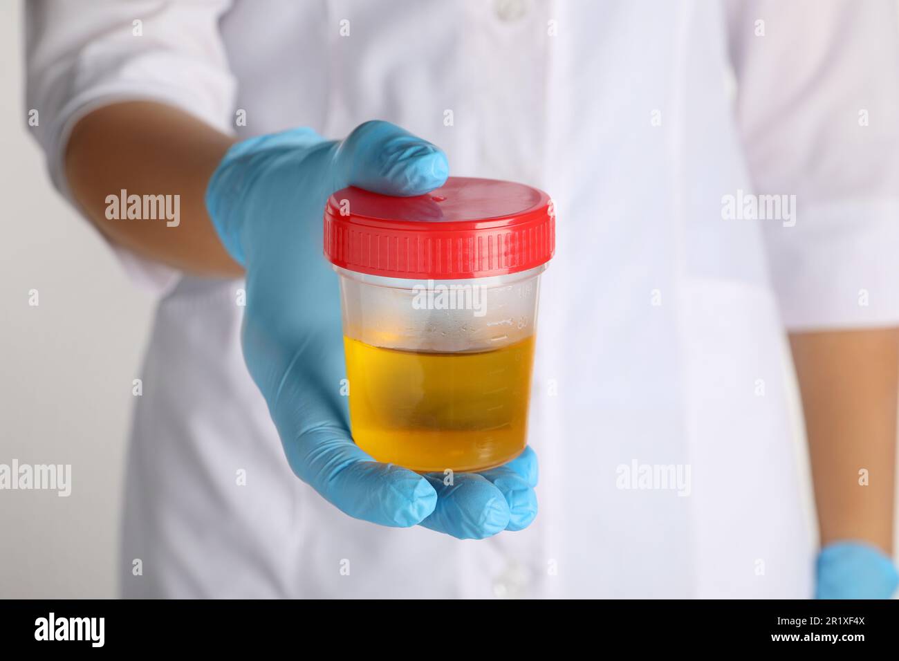 Nurse holding container with urine sample for analysis on white ...