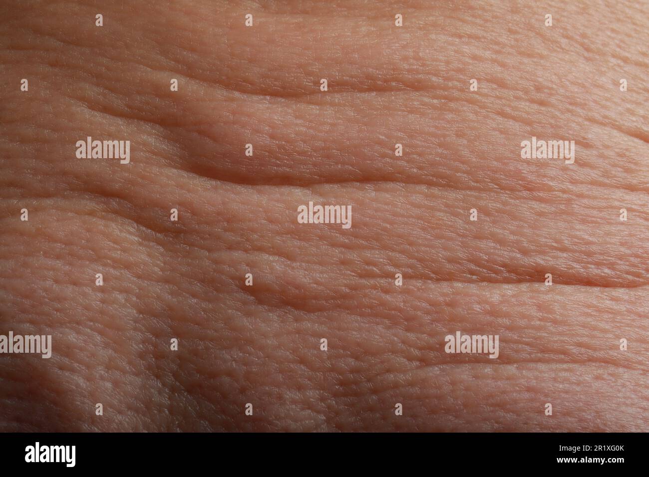 Normal skin hi-res stock photography and images - Alamy