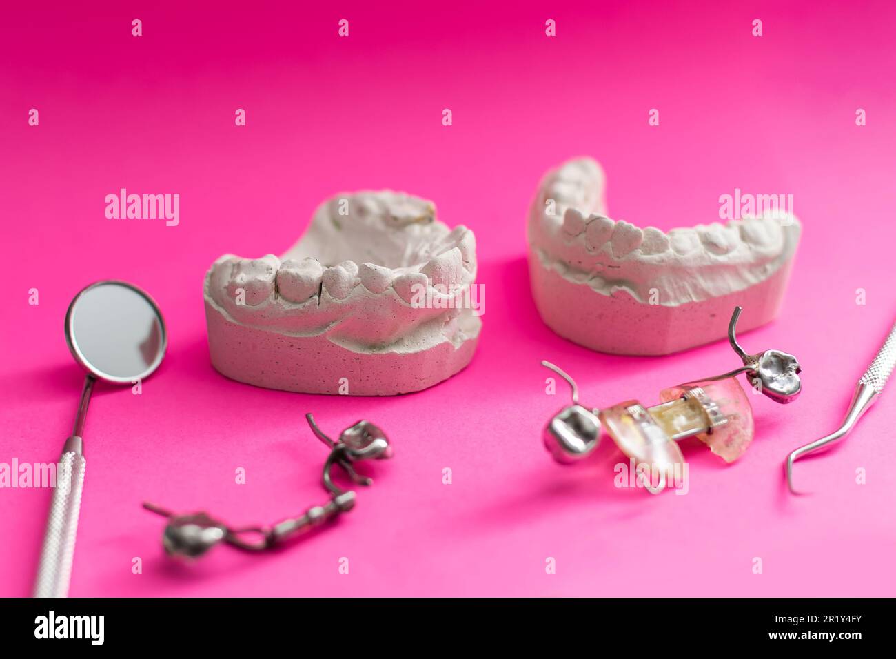 Dental models top view. Jaw models with different problems. Treatment ...