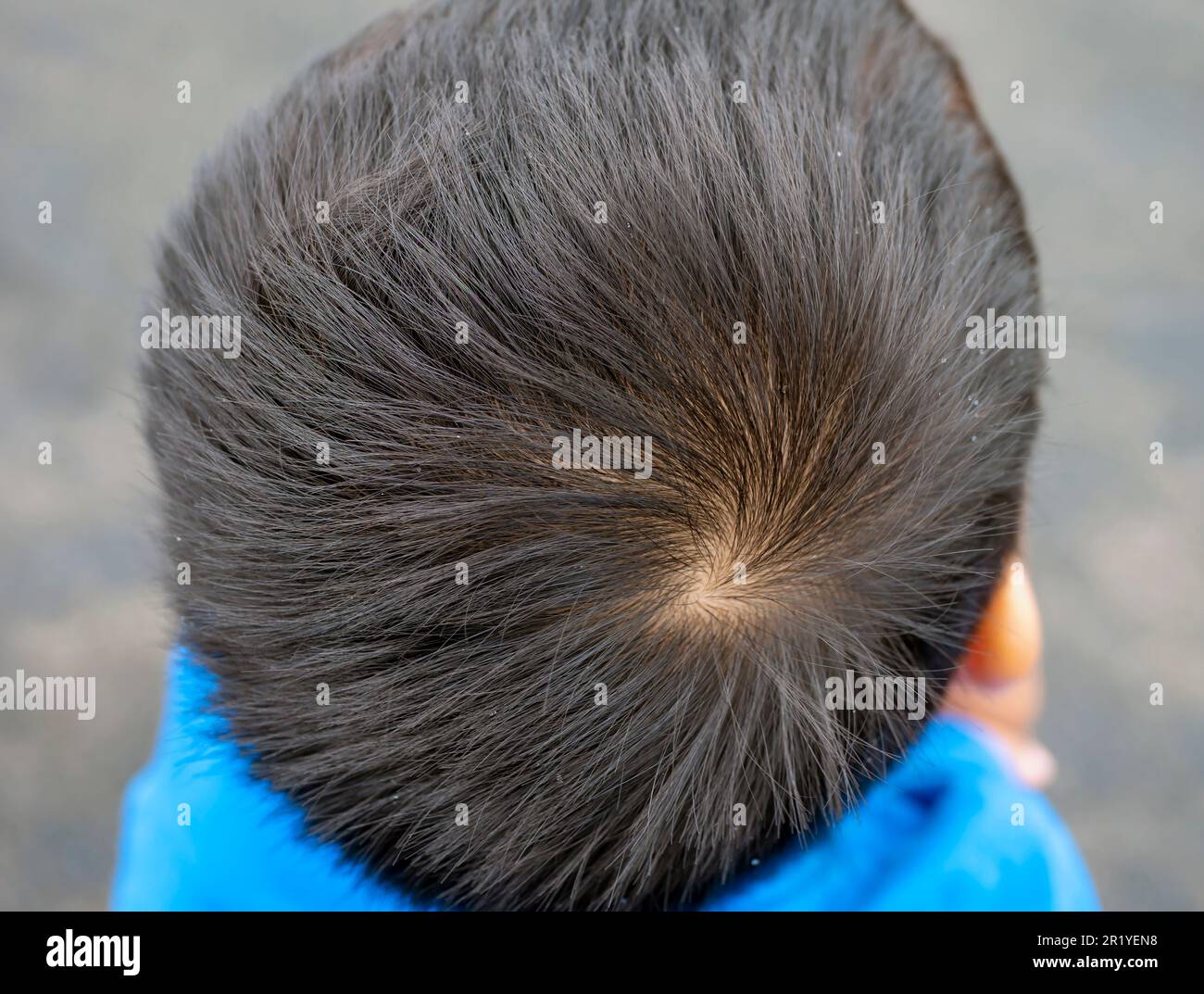 A hair whorl, a circular direction around center point on the human ...
