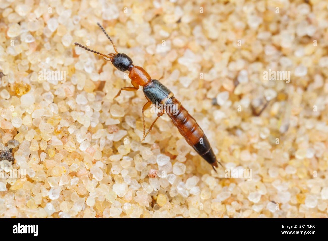 Rove Beetle Dermatitis