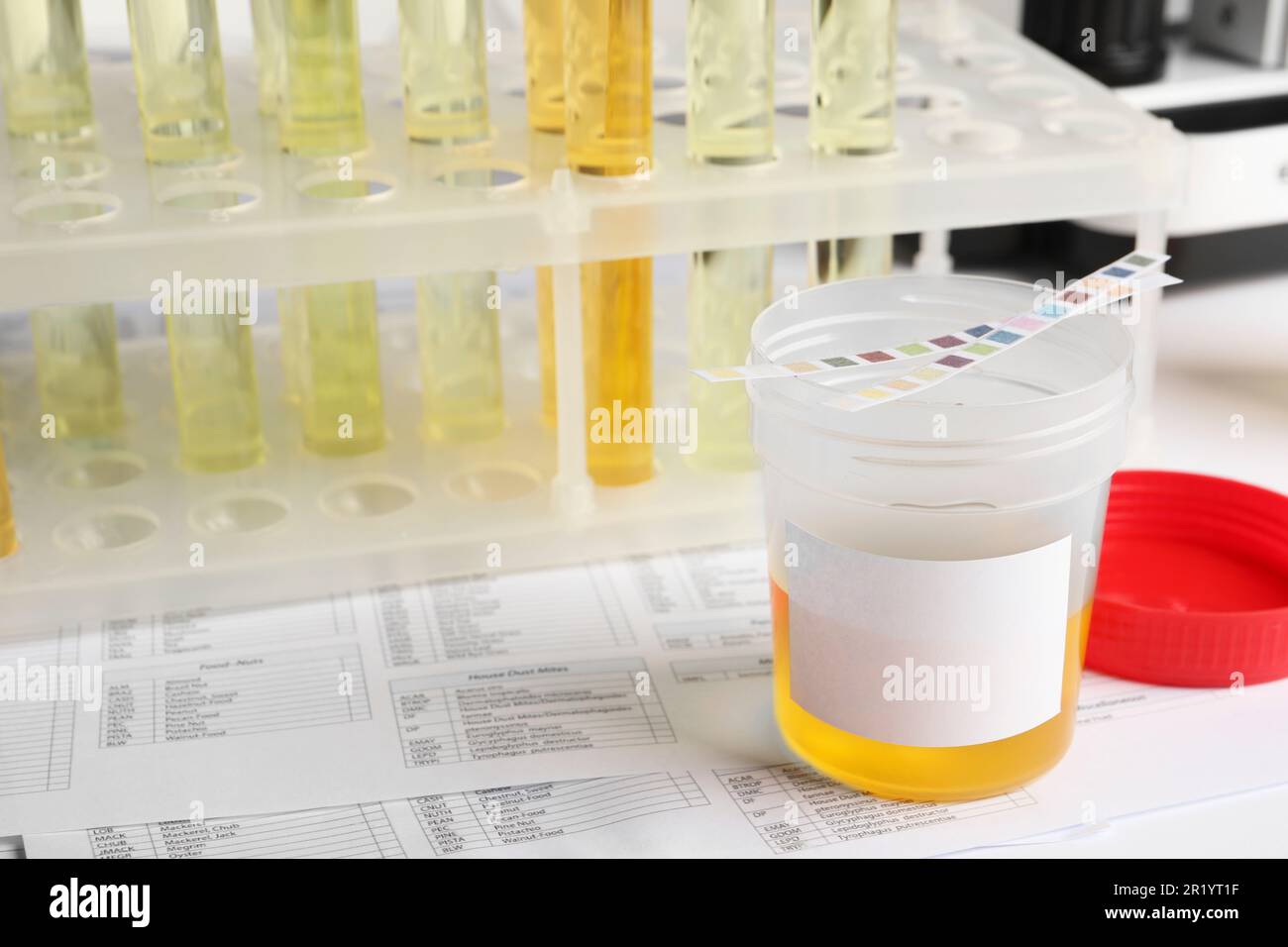 Container with urine sample on table, space for text. Specimen ...