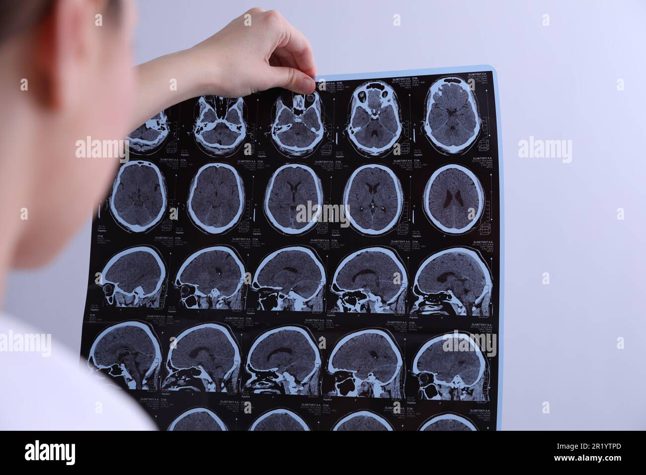 Doctor examining MRI images of patient with multiple sclerosis in ...