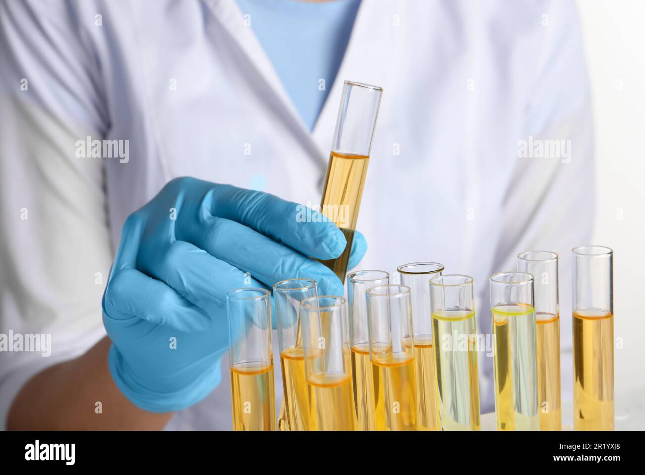 Nurse holding tube with urine sample for analysis on white background ...