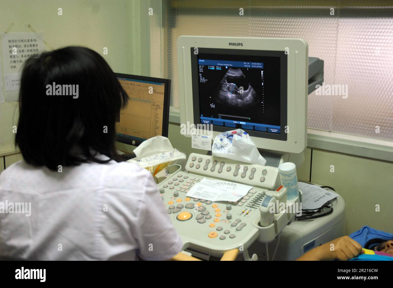 Lung washing hi-res stock photography and images - Alamy