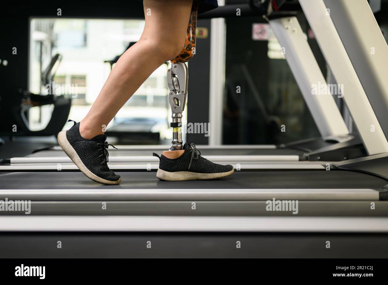 Disabled athlete patient with prosthetic leg doing exercise at gym ...