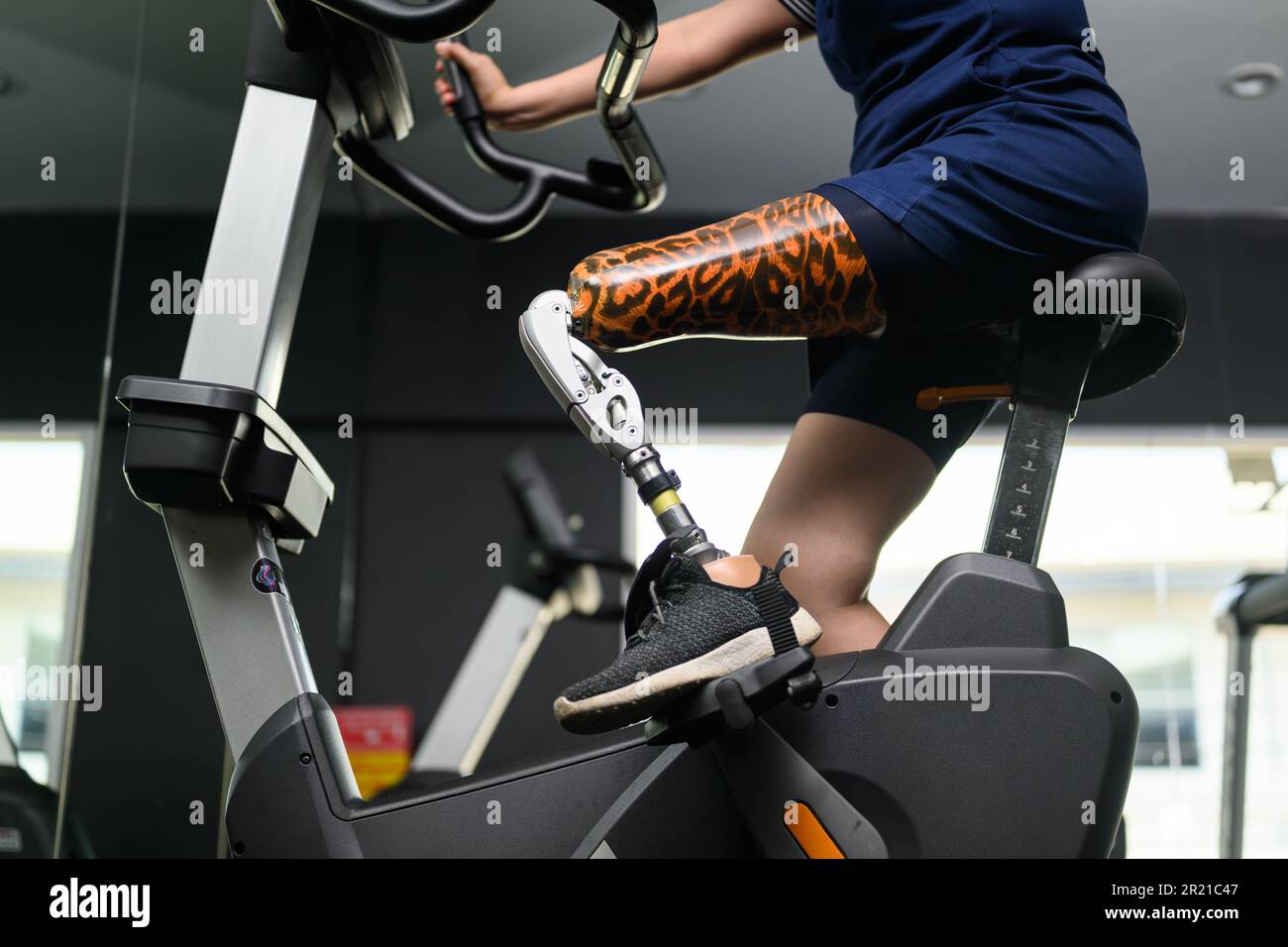 Disabled athlete patient with prosthetic leg doing exercise at gym ...
