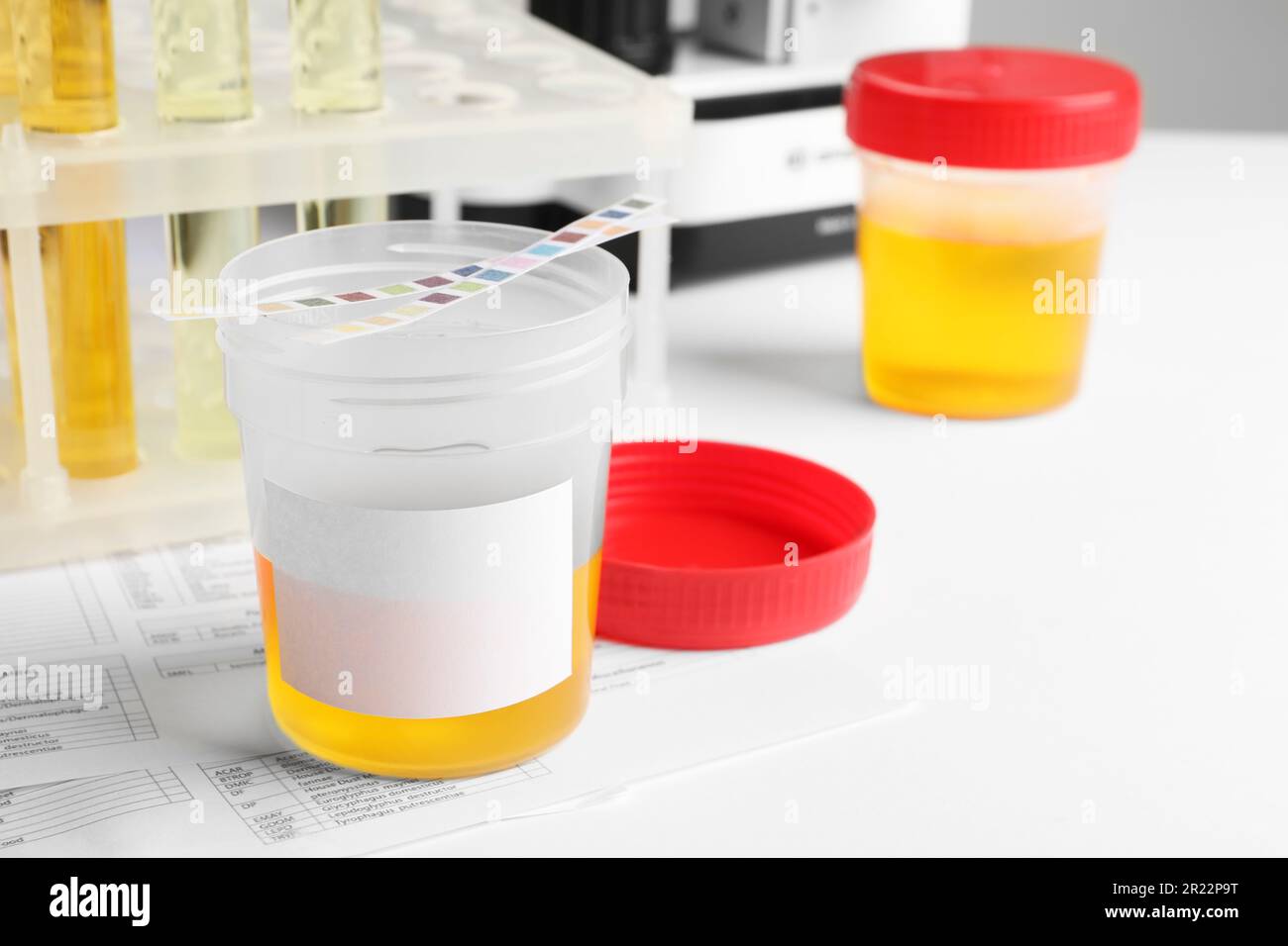 Container with urine sample on white table, space for text. Specimen ...