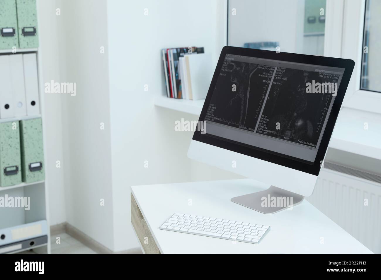 Mri of neck hi-res stock photography and images - Alamy