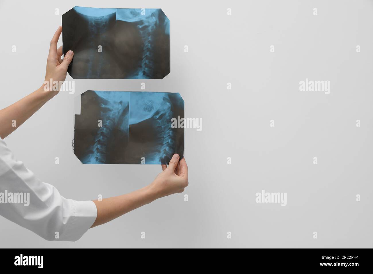 Doctor examining neck MRI images on light grey background, closeup ...