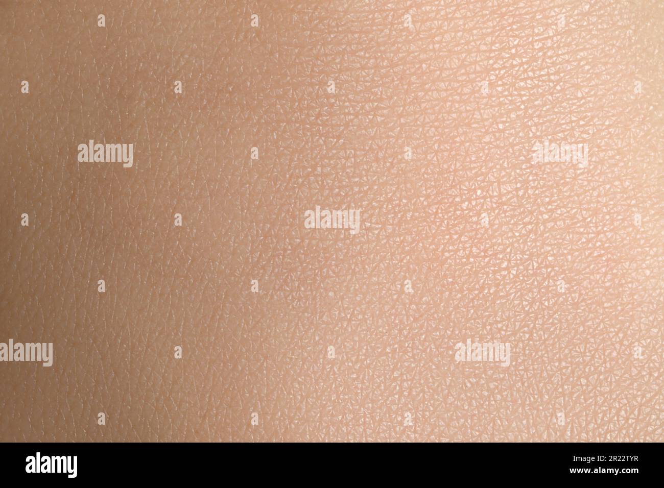 Closeup view of dry human skin as background Stock Photo - Alamy