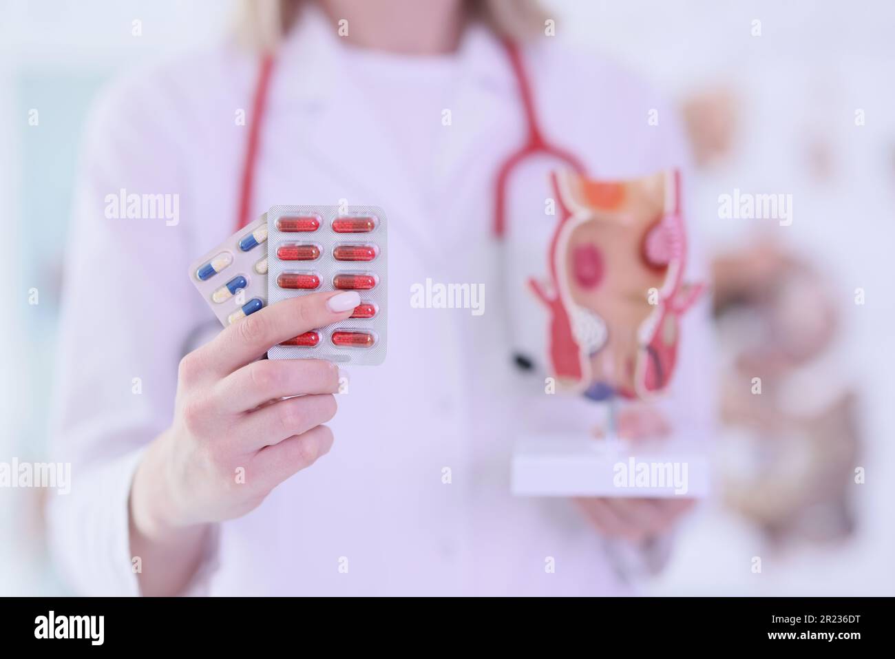 Female doctor holds pills and model of rectum in hands Stock Photo - Alamy