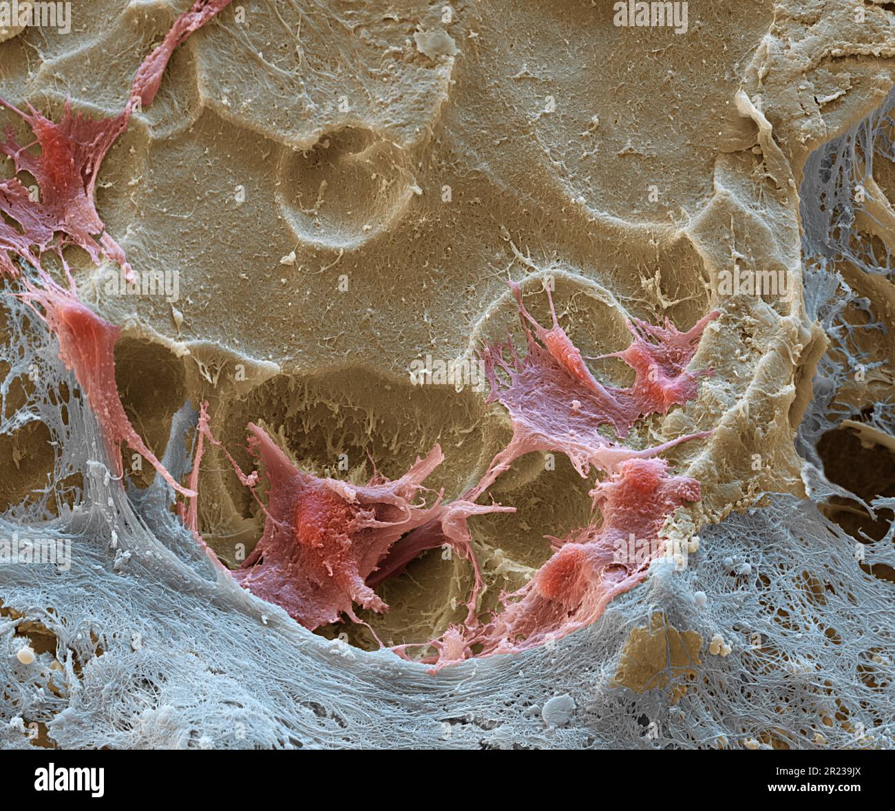 Osteoclast cells on bone, SEM Stock Photo - Alamy