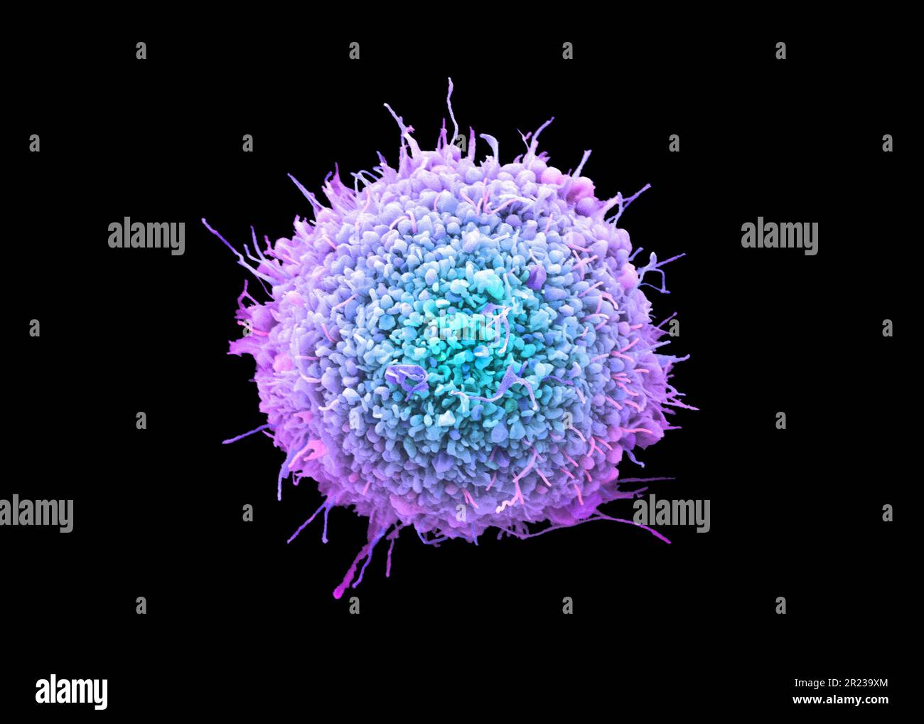 Cervical cancer cell, SEM Stock Photo - Alamy