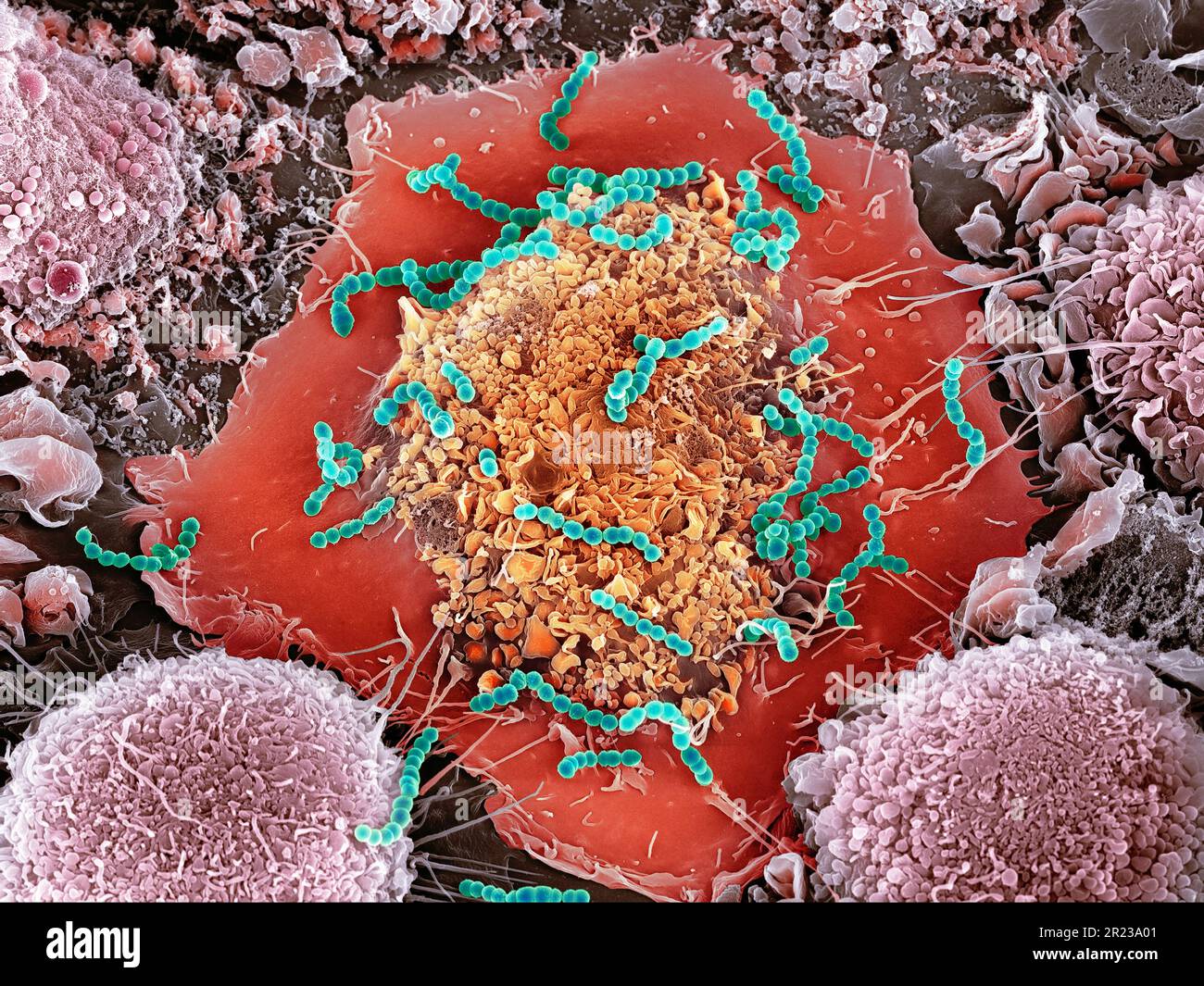 Macrophages infected with Streptococcus pyogenes, SEM Stock Photo - Alamy