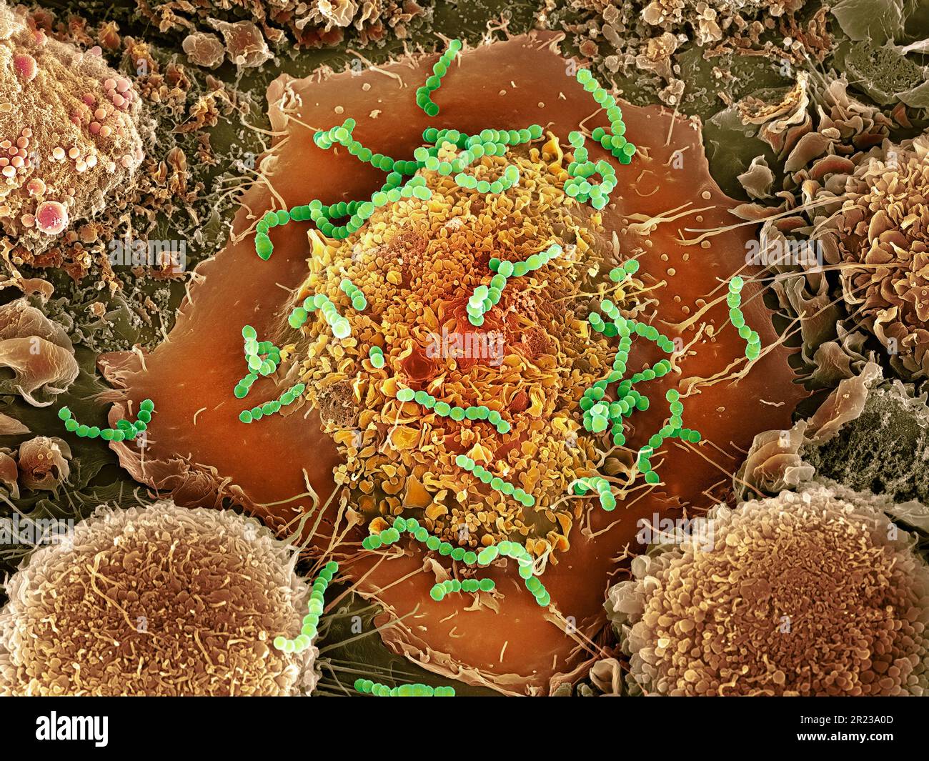 Macrophages infected with Streptococcus pyogenes, SEM Stock Photo - Alamy