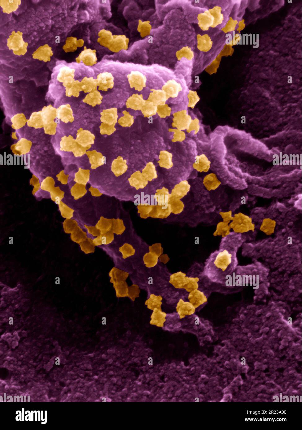 Cell infected by SARS-CoV-2 virus particles, SEM Stock Photo - Alamy
