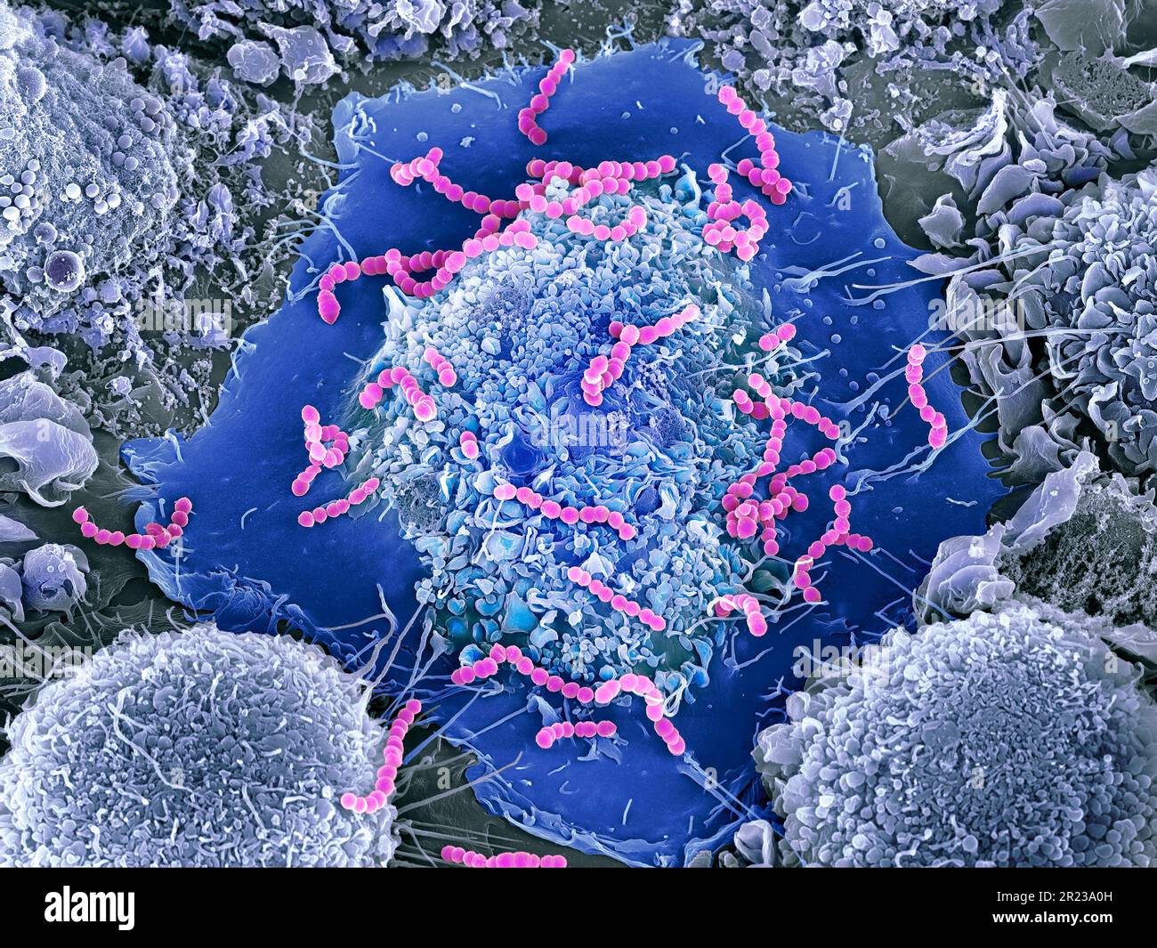 Macrophages infected with Streptococcus pyogenes, SEM Stock Photo - Alamy