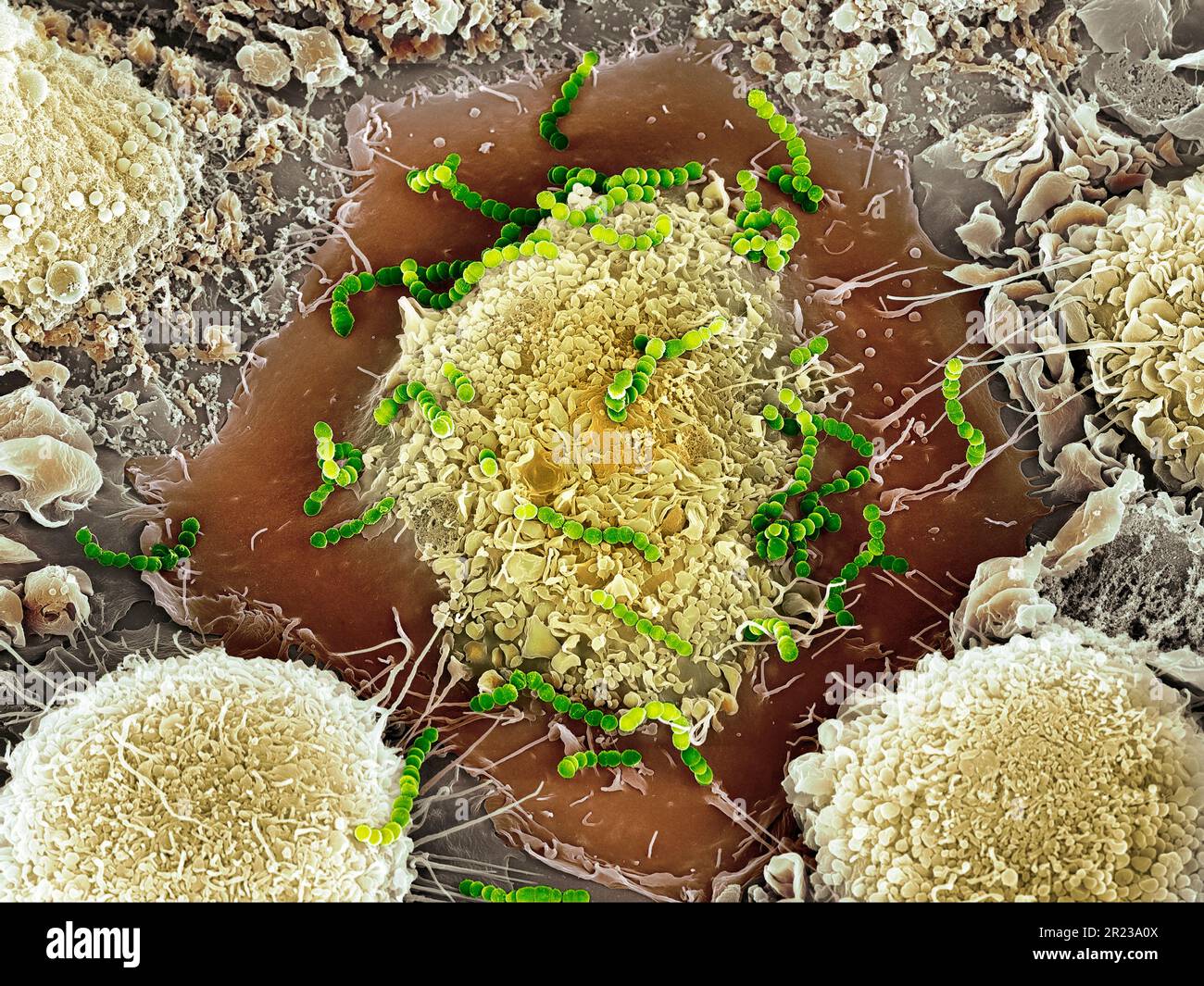 Macrophages infected with Streptococcus pyogenes, SEM Stock Photo - Alamy