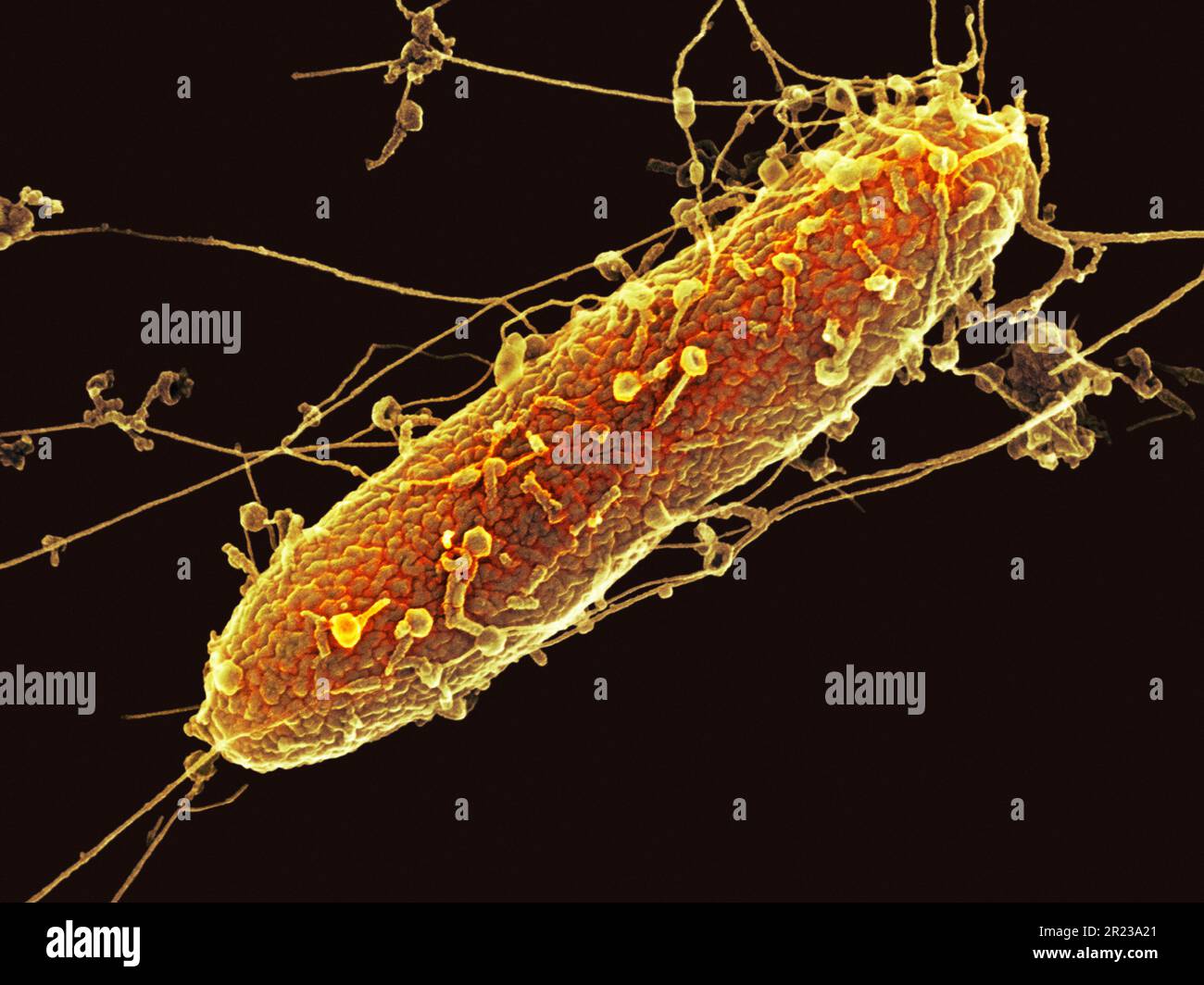 Bacteriophages attacking Pseudomonas aeruginosa bacterium, SEM Stock ...