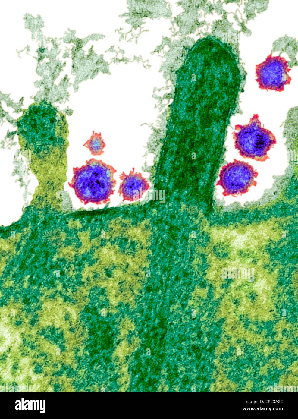 Cell infected by SARS-CoV-2 virus particles, TEM Stock Photo - Alamy
