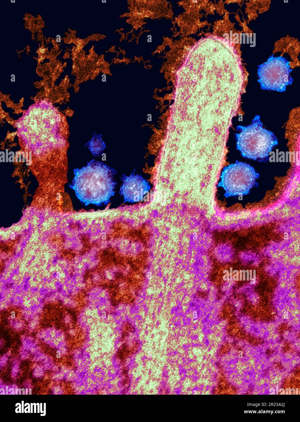 Cell infected by SARS-CoV-2 virus particles, TEM Stock Photo - Alamy