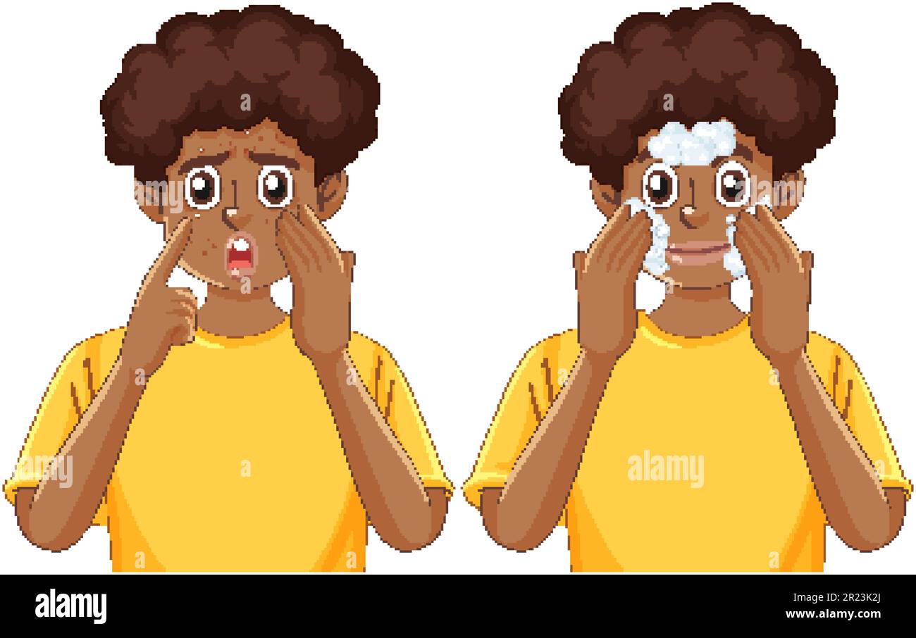 Teenage Boy with Skin Problem illustration Stock Vector Image & Art - Alamy
