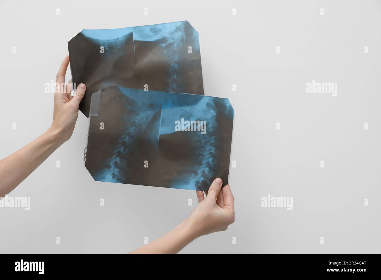 Doctor examining neck MRI images on light grey background, closeup ...