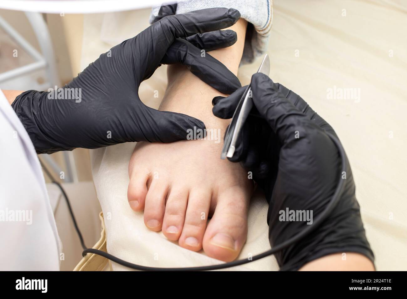 Cropped Dermatologist Doing Hair Removal Electrolysis Procedure On ...
