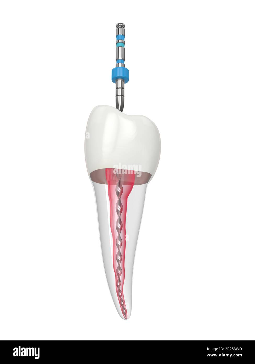 3d render of premolar tooth with endodontic rotary file over white ...