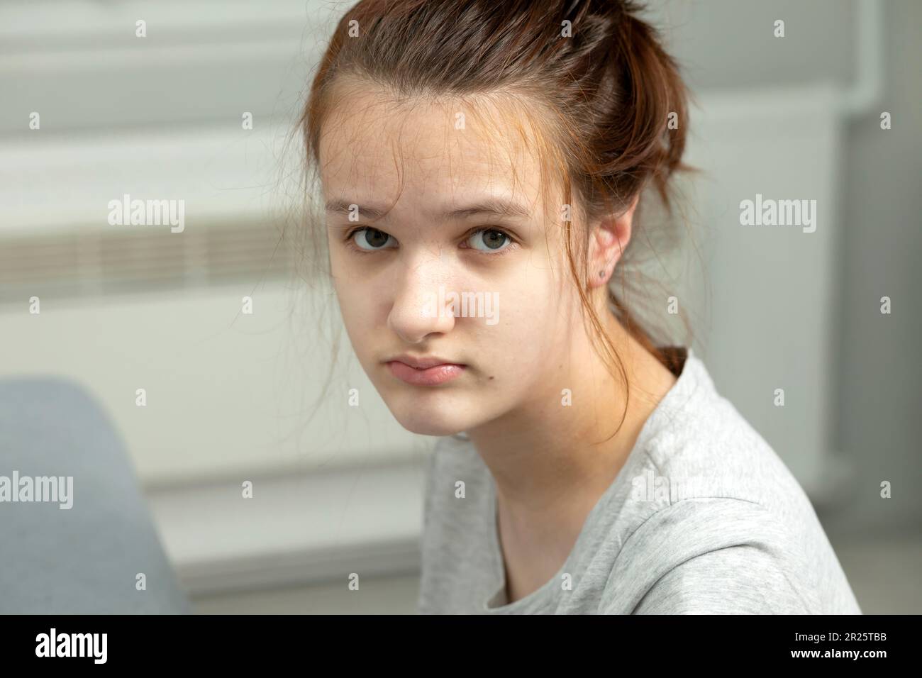 Portrait Of Sad Child, Girl With Disability in Hospital Looking At ...