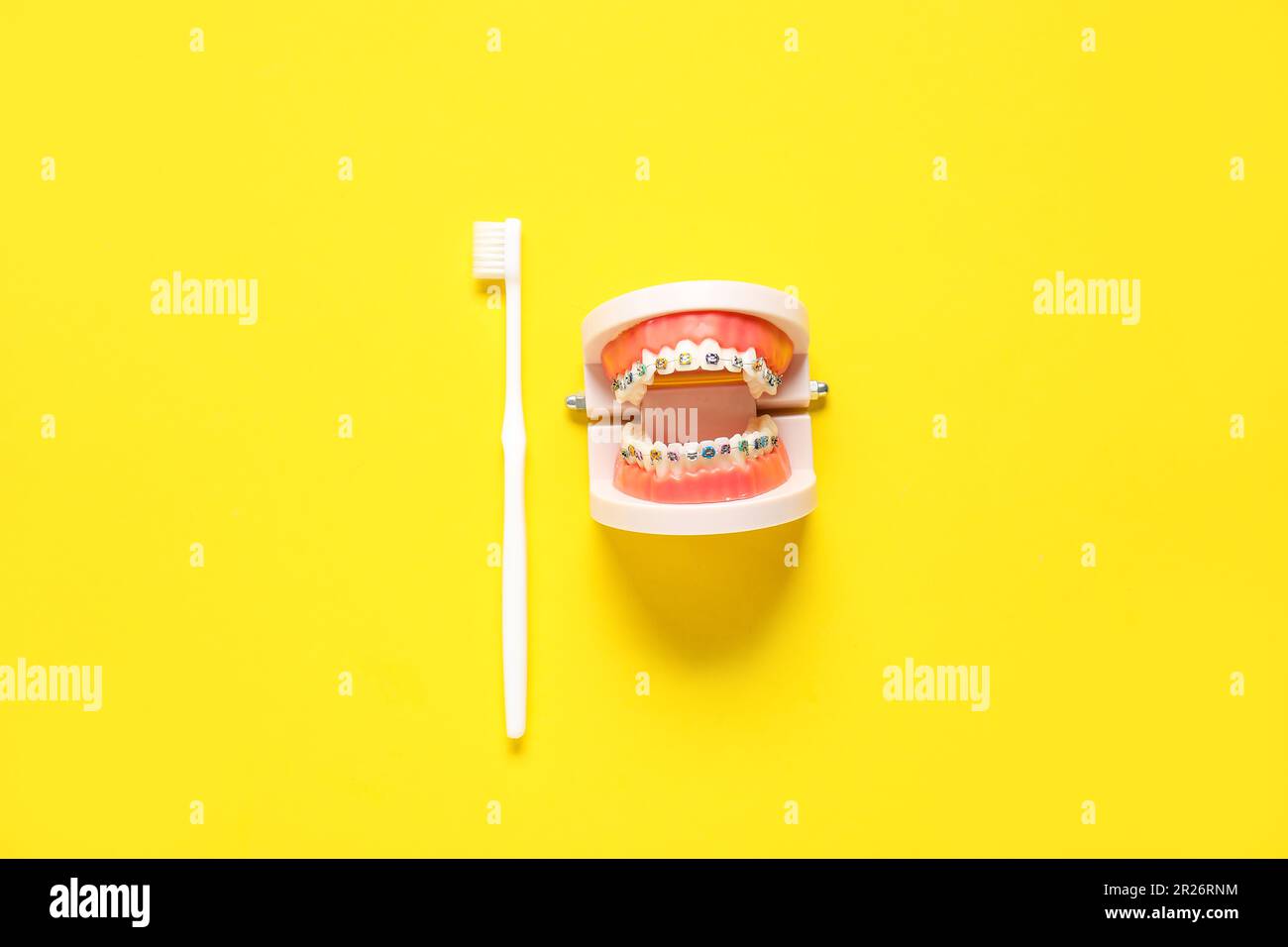 Model of jaw with dental braces and toothbrush on yellow background ...