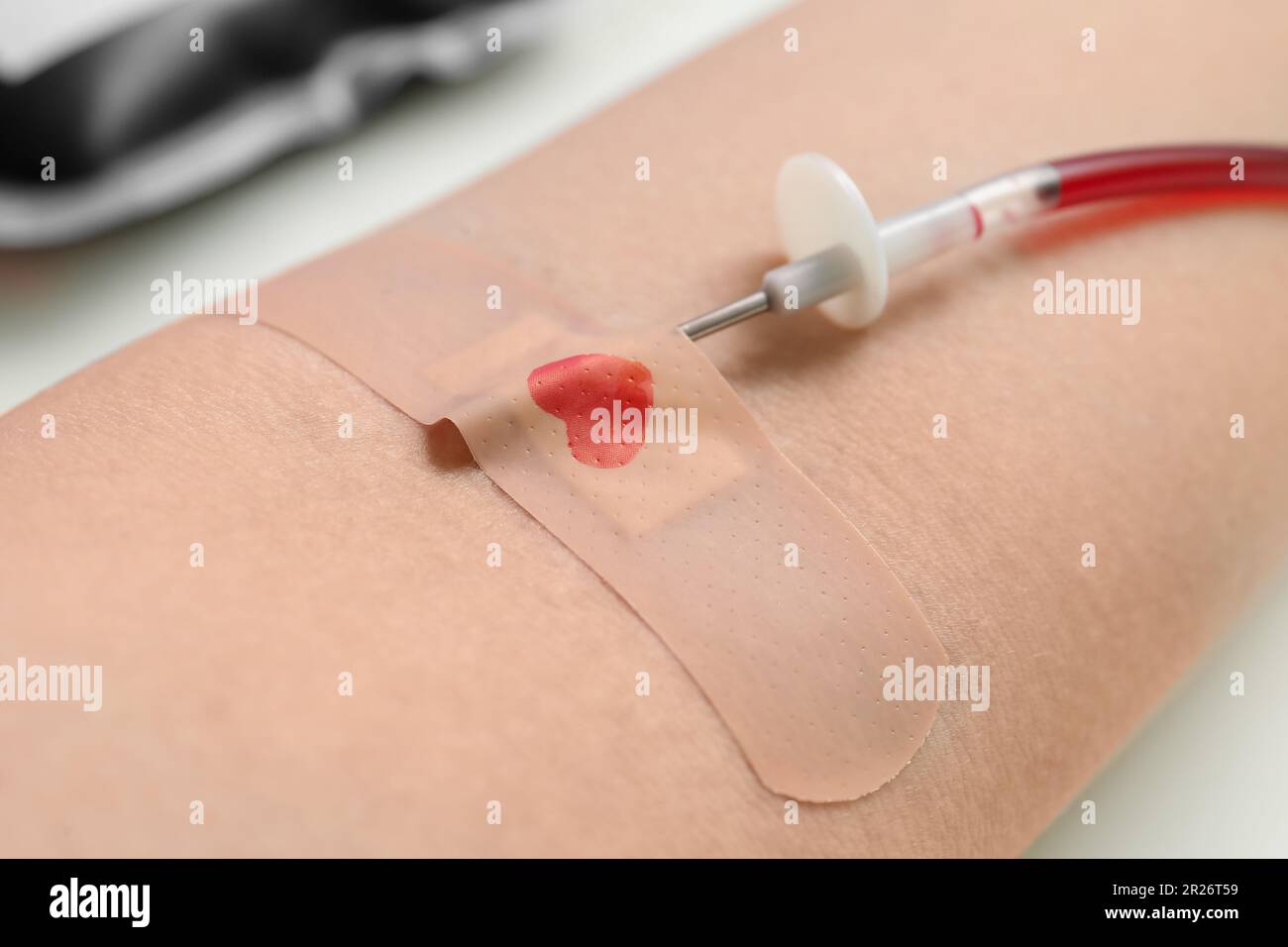 Woman donating blood on beige background, closeup. World Donor Day ...
