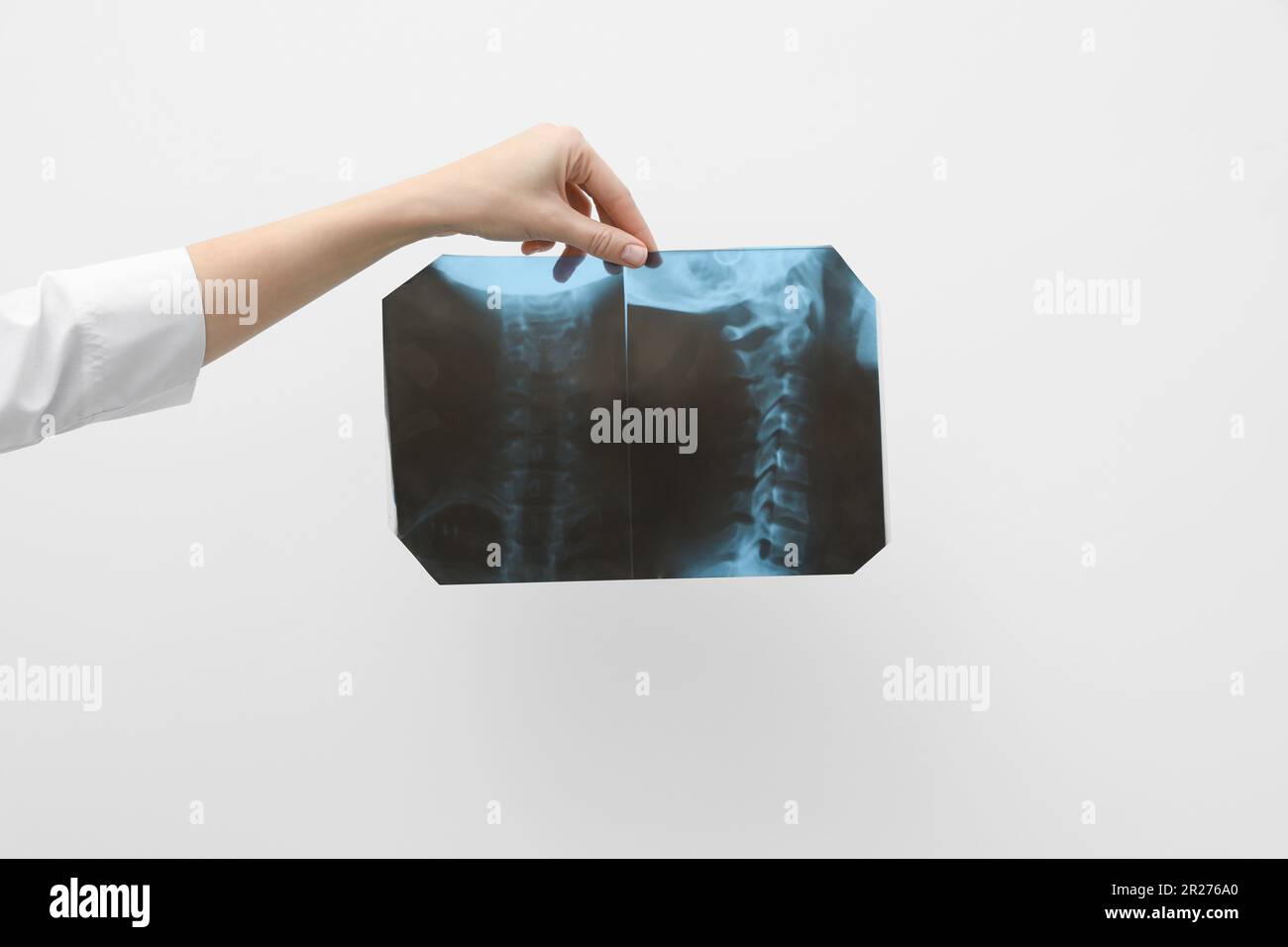 Doctor examining neck MRI image on light grey background, closeup Stock ...